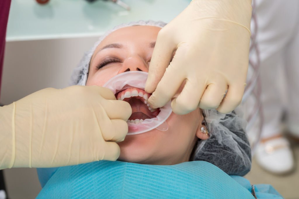 What To Expect After Receiving Your Crown: The Dental Crown Healing ...